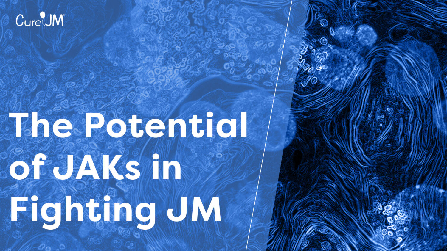 Resources - Cure JM Foundation