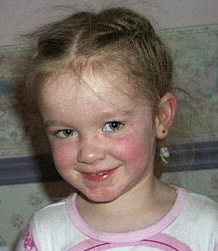 What is Juvenile Myositis? - Cure JM Foundation